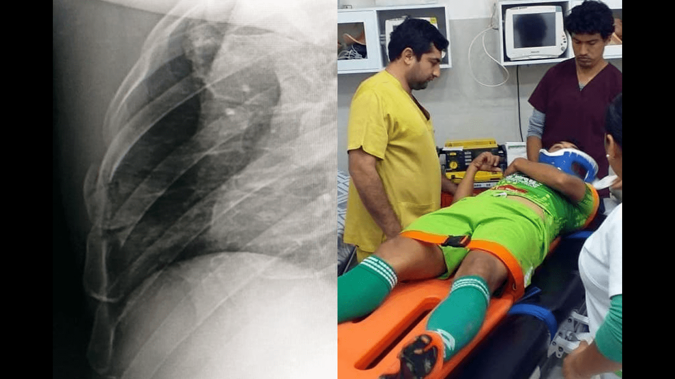 ¡terrible Luis Hernán Melgar Sufrió Una Triple Fractura De Costilla
