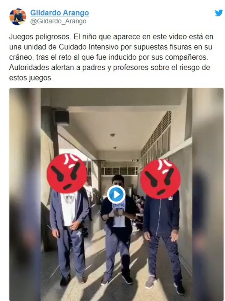 Rompe Cráneos El Nuevo Reto Viral Entre Adolescentes Que Es Mortal 6895