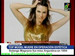 Modelo argentina muere tras operación estética – eju.tv