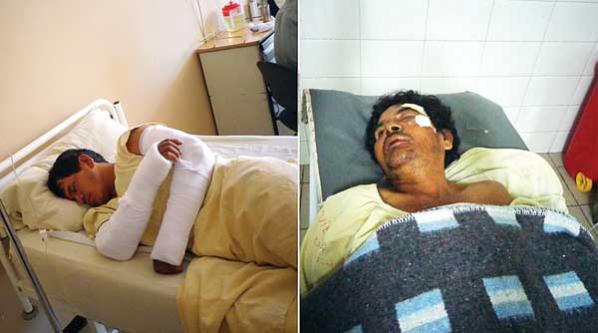 Cochabamba: Una persona se salva de morir quemada y otra de ser ...