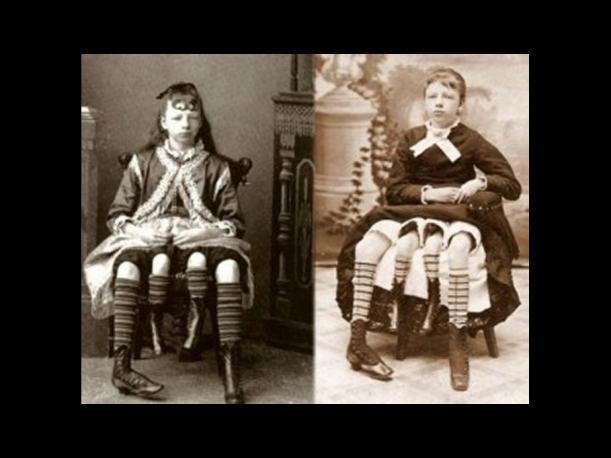 ¡Sorprendentes! Los diez casos médicos más extraños en el mundo – eju.tv