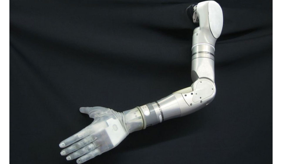 Una mano protésica devuelve a un hombre el sentido del tacto – eju.tv