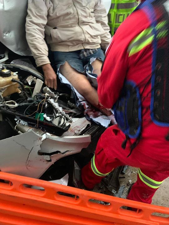 Hombre quedó incrustado en el motor de un vehículo tras el choque con ...